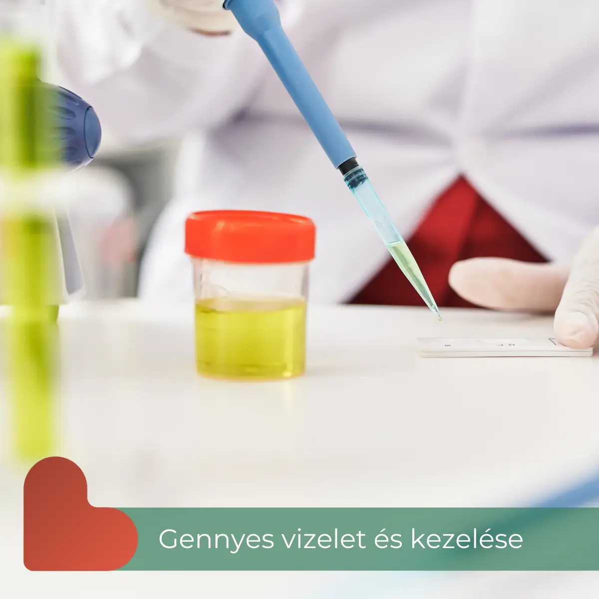 Gennyes Vizelet