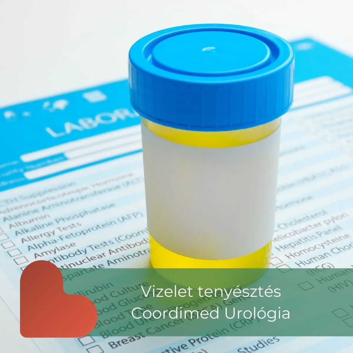 Vizelet tenyésztés